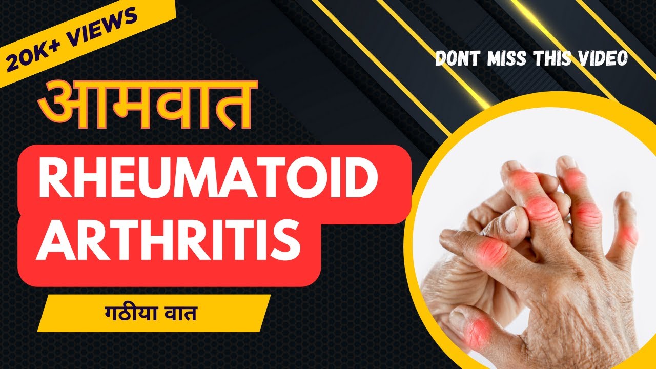 Rheumatoid Arthritis| Aamvat| Gathiya Vat|Dr. Mayuri - YouTube