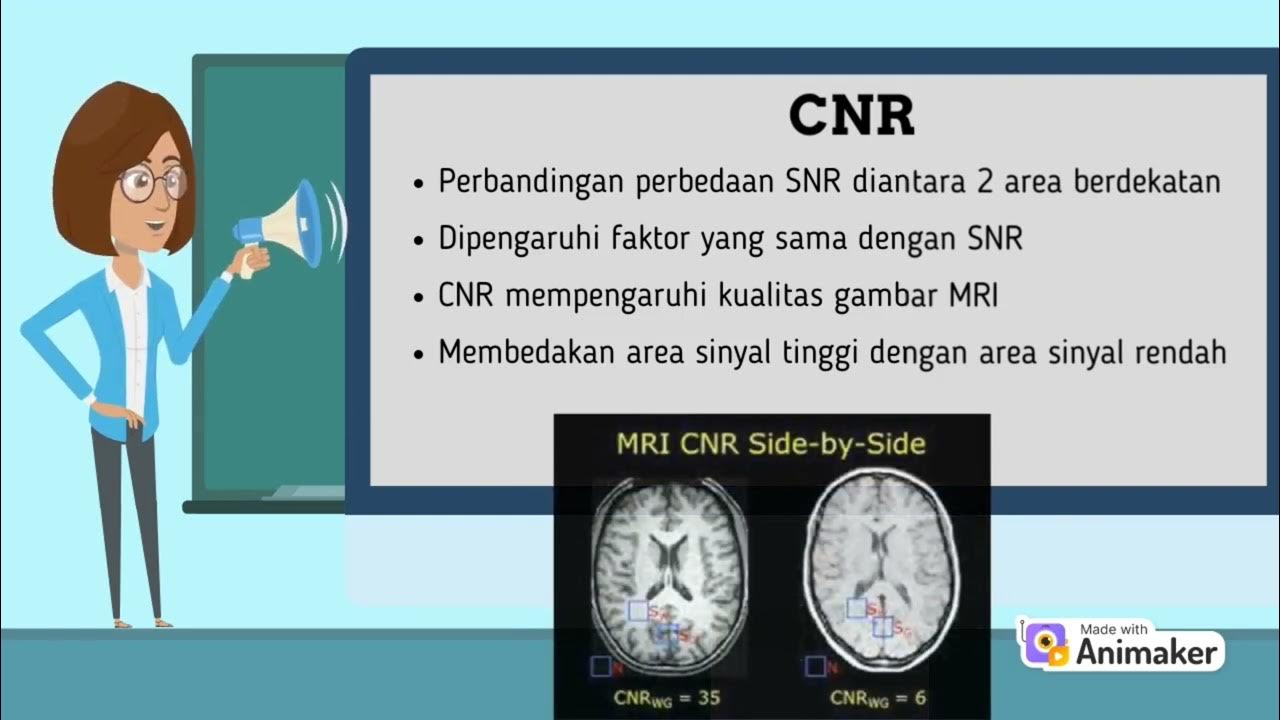 PARAMETER DAN TRADE OFF PADA MRI - YouTube