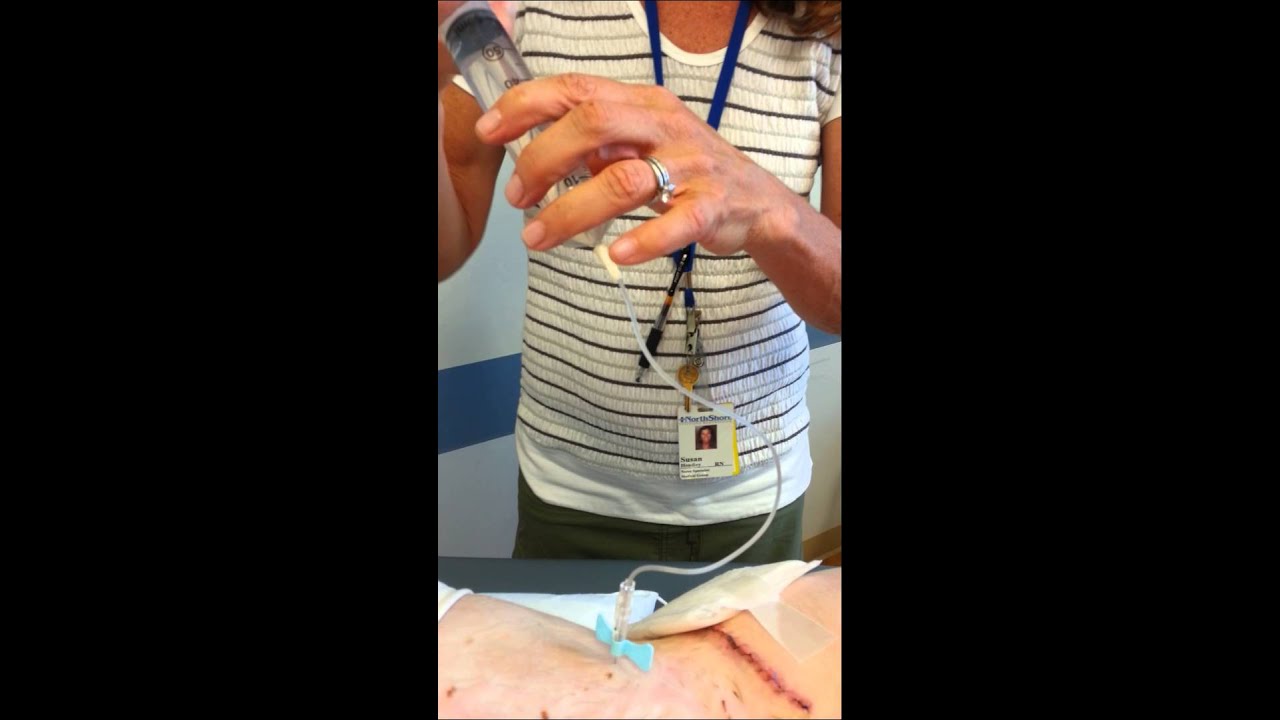 Tissue Expansion for Skin Nevus Reconstruction - YouTube