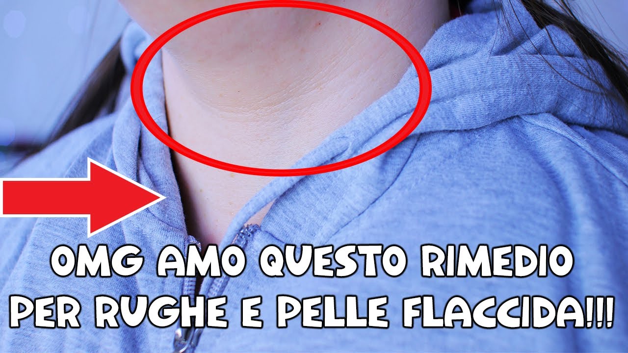 Collo Rugoso? Con Questo Rimedio Naturale preverrai questa cosa - YouTube