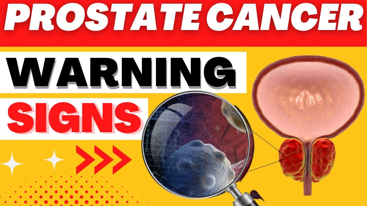 Prostate Cancer Signs | Warning Signs of Prostate Cancer & Causes ...