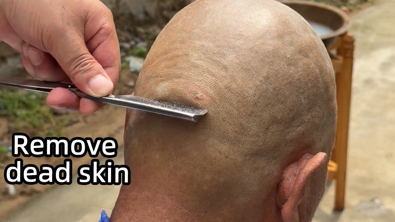 💈ASMR | Remove dead skin from the man's head and face! 🪒 Wonderful ...