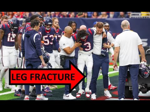Tank DELL Leg Fracture - Dr. Wilson Explains - YouTube