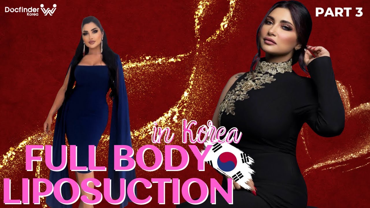 Full Body Liposuction in Korea | Part 3 | Plastic surgery experience by ...