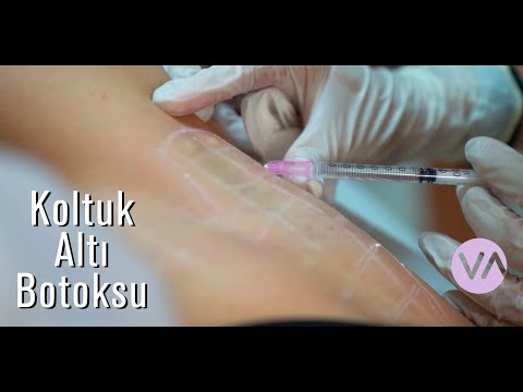 Selma Çiçekdal | Koltuk Altı Botoks | Vanity Estetik