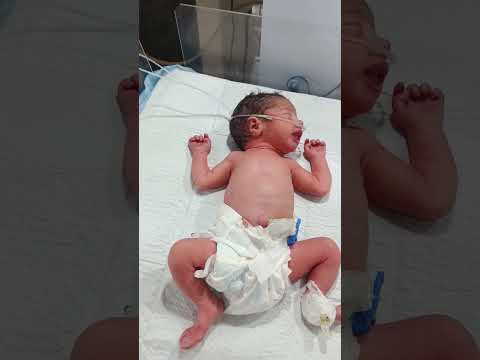 How to Perform Airway Suction in NICU Babies | Safe & Sterile Steps ...