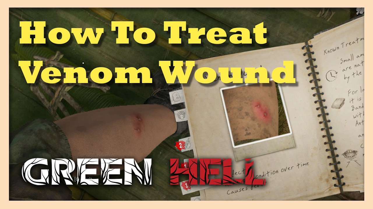 How to Treat Venom and Poison Wounds in Green Hell | Beginner Guide ...