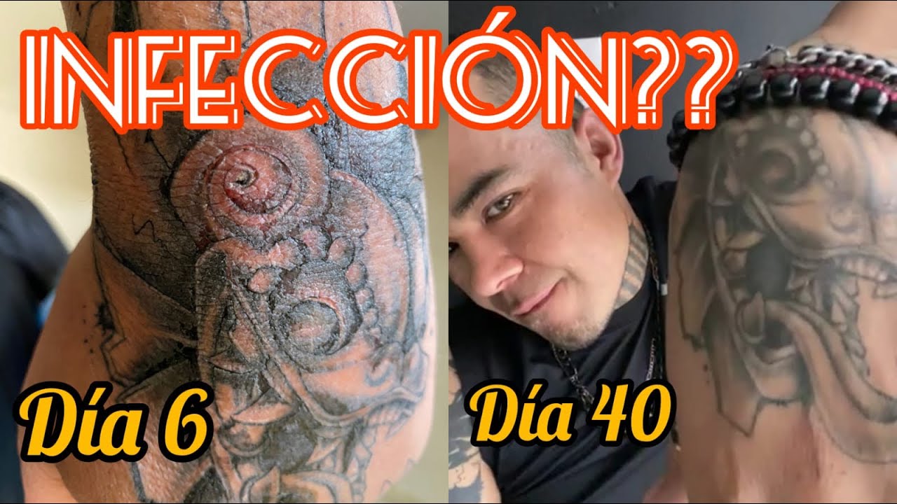 ¿Por qué se infecto mi Tatuaje? 🥴 [cómo curar tattoo en mal estado]🤒 ...
