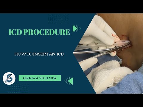 How to insert an ICD (Intercostal drainage tube) tube. The Scalpel/ Dr ...