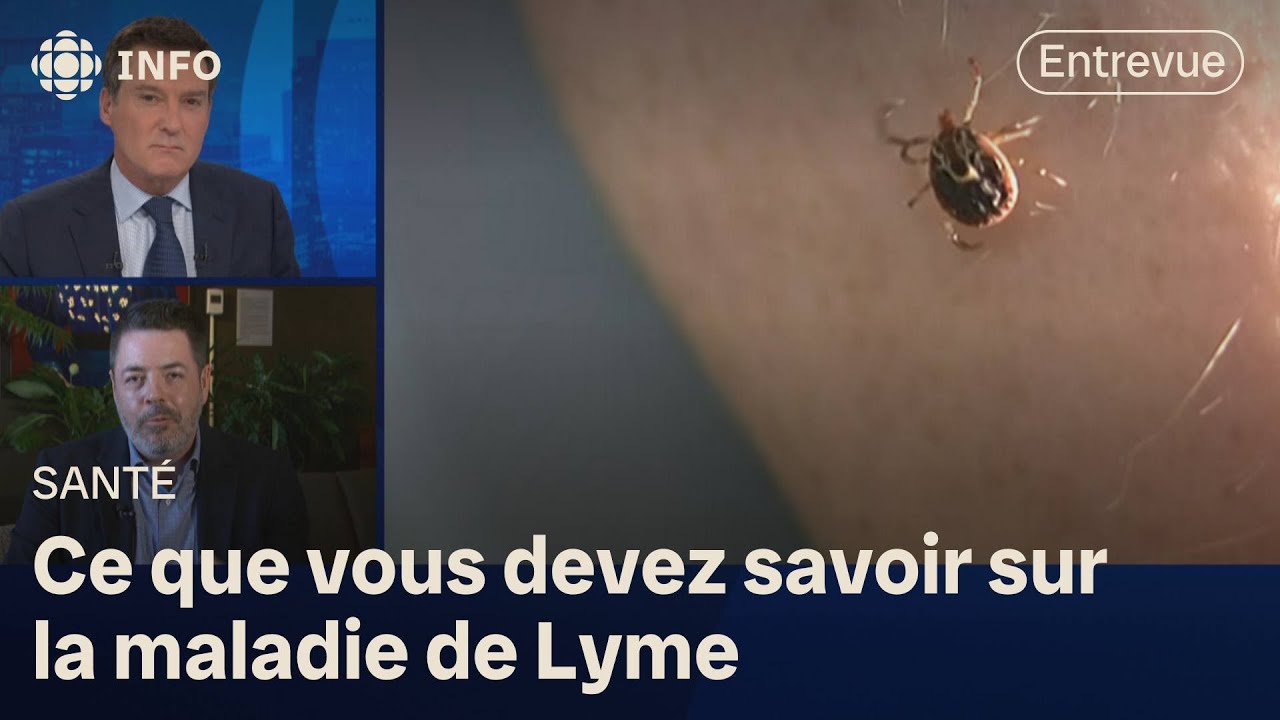 Une nouvelle chaire sur la maladie de Lyme : entrevue avec le Dr Alex ...