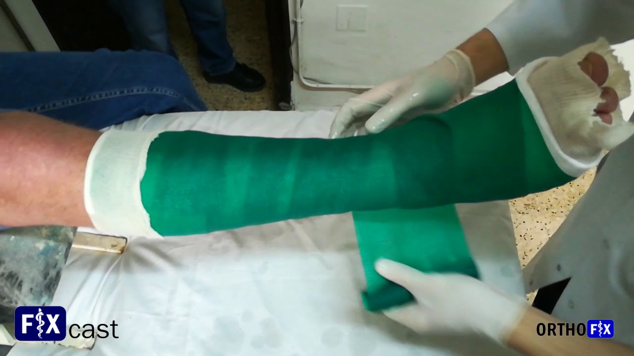 ORTHOFIX FIXCAST - YouTube