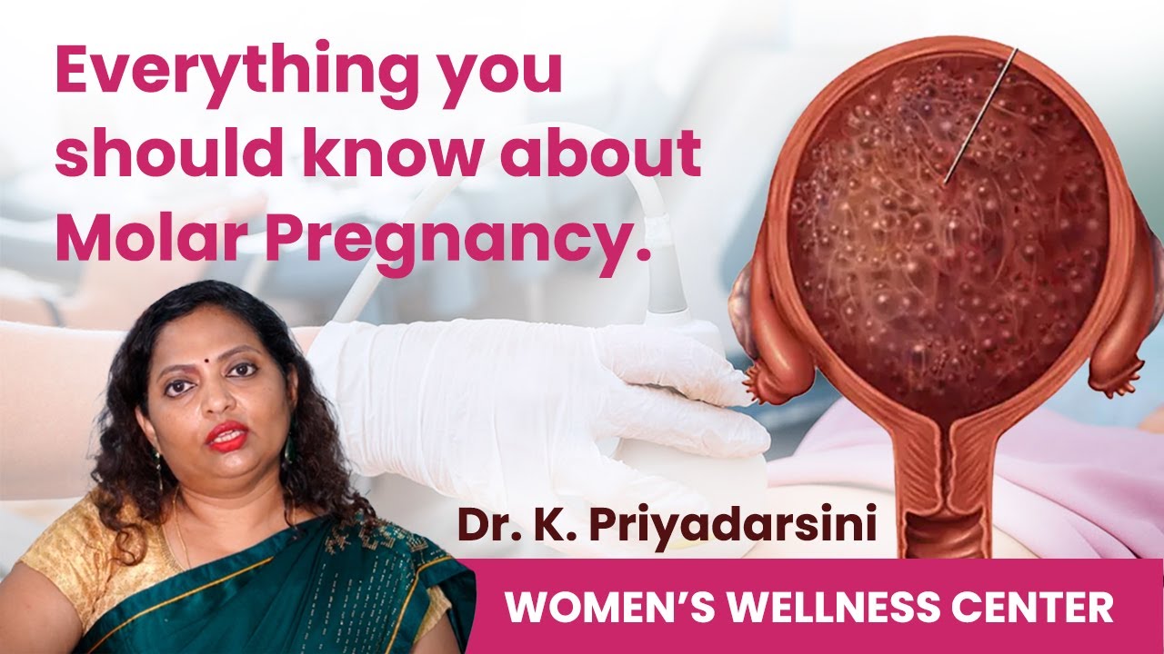 Everything To Know About Molar Pregnancy Dr Priyadarsini Youtube