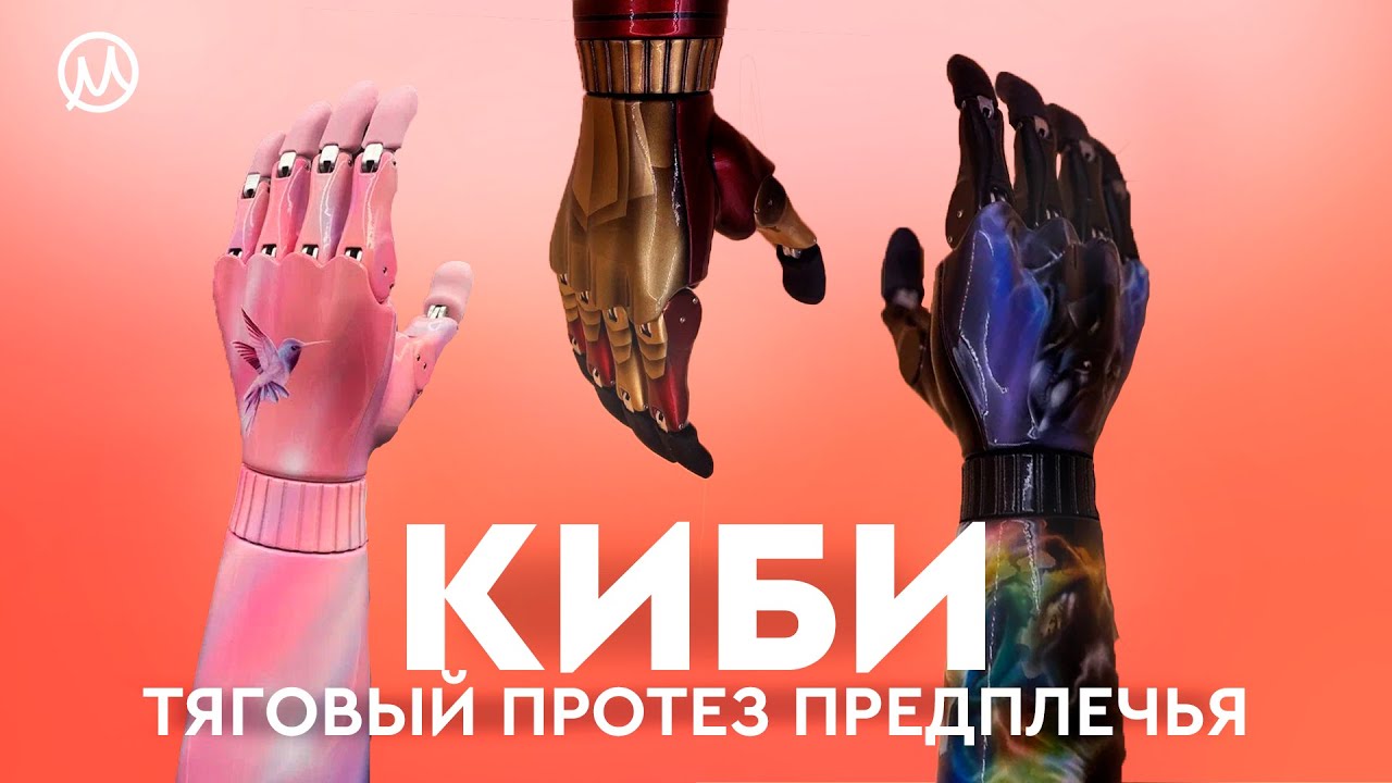 Активный протез предплечья CYBI Hand: простое использование ...