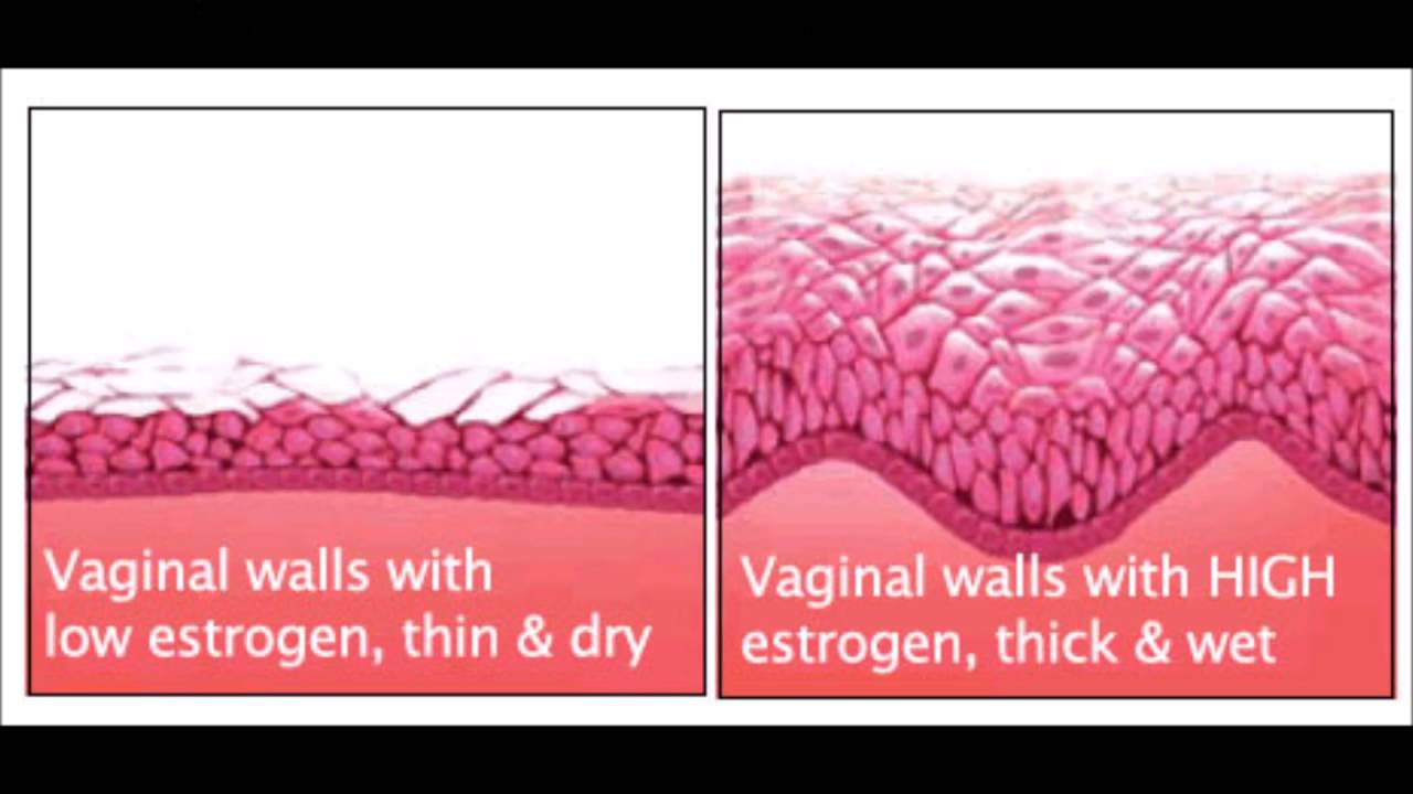 How Does Menopause Change Your Vagina - YouTube