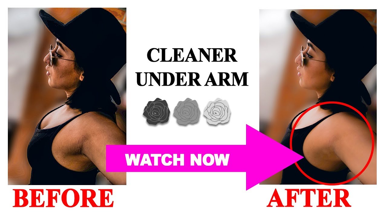 How to Get Rid of Underarm Darkness and Bumps [FAST] - YouTube