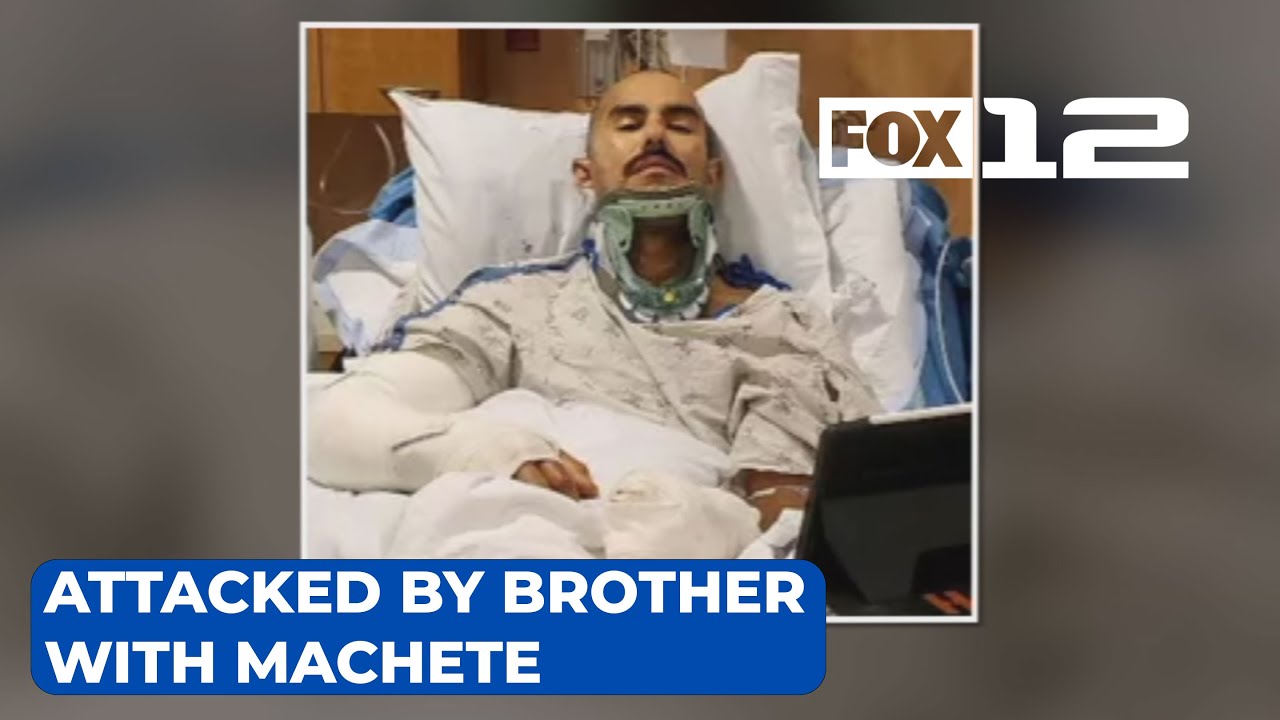 Amity man recovering after machete attack by brother - YouTube