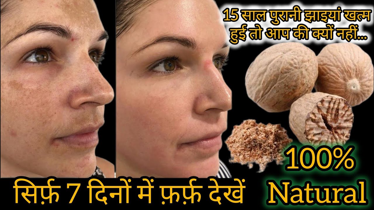 दाग़ धब्बें दूर और गोरी त्वचा ll जायफल इस्तेमाल करने का सही तरीका ll ...