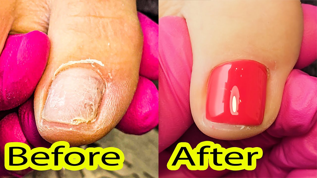 👣Pedicure Transformation 🧡 Nail Design ideas - YouTube