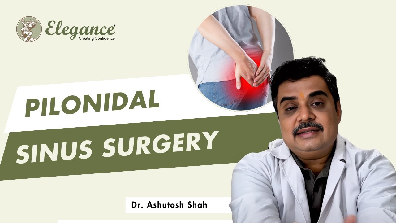 Laser-Assisted Pilonidal Sinus Excision | Advanced Treatment | Elegance ...