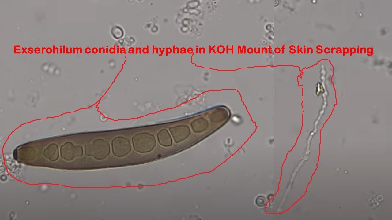 Skin Koh