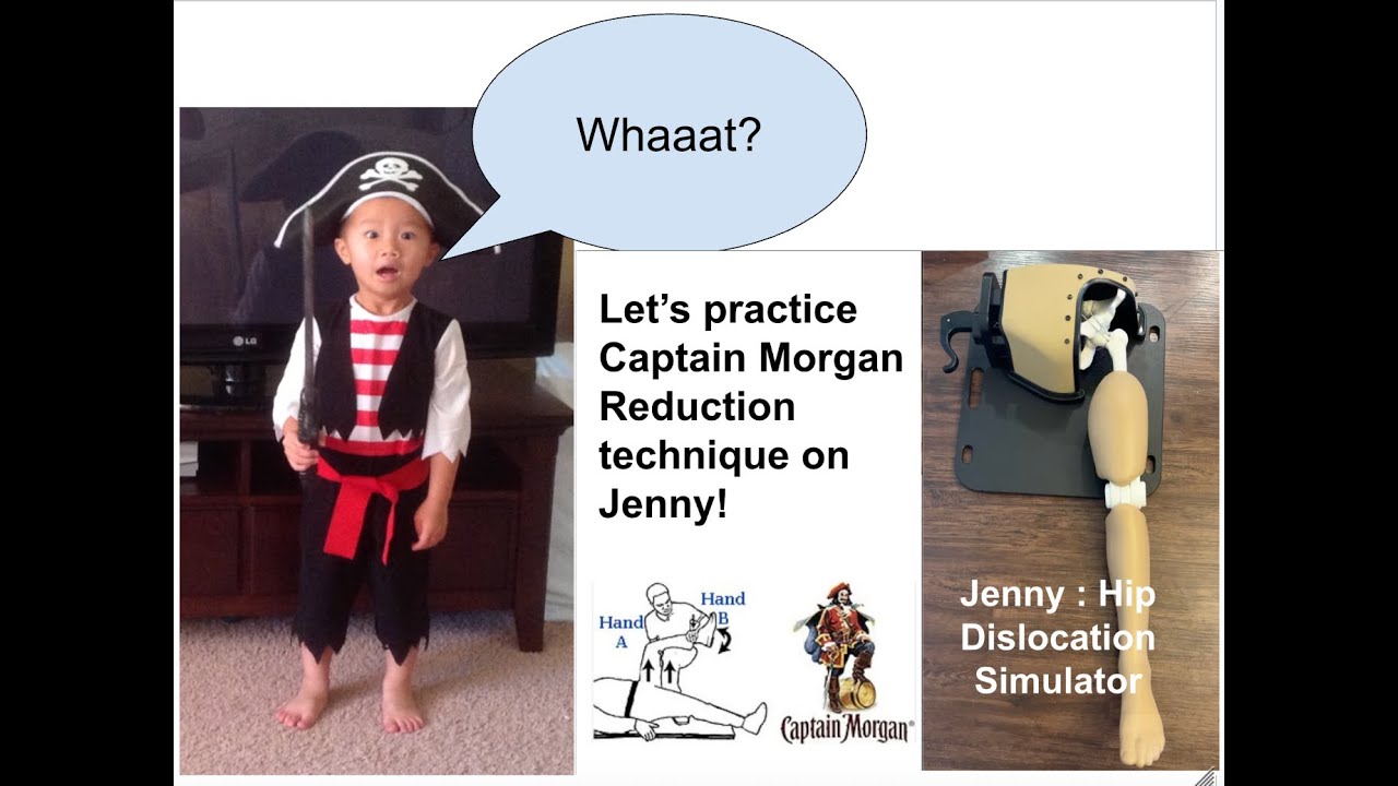 Captain Morgan Technique step by step on Jenny | Sports Medicine # ...