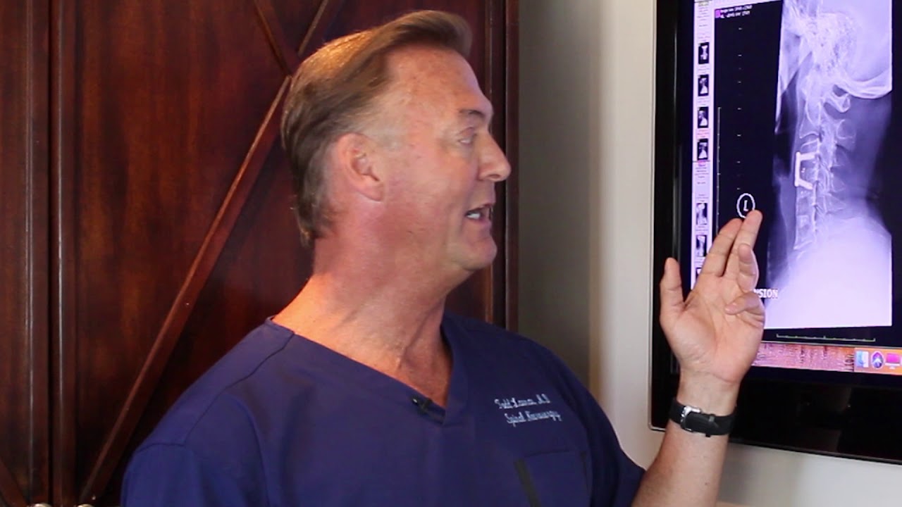 Can you remove cervical fusions and restore movement? | Dr. Todd Lanman ...