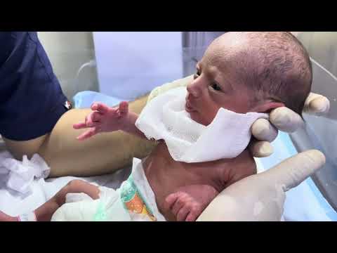 Feeding Adorable Premature Baby | Tiny Miracle Feeding Moments #PrematureBaby #AdorableBaby