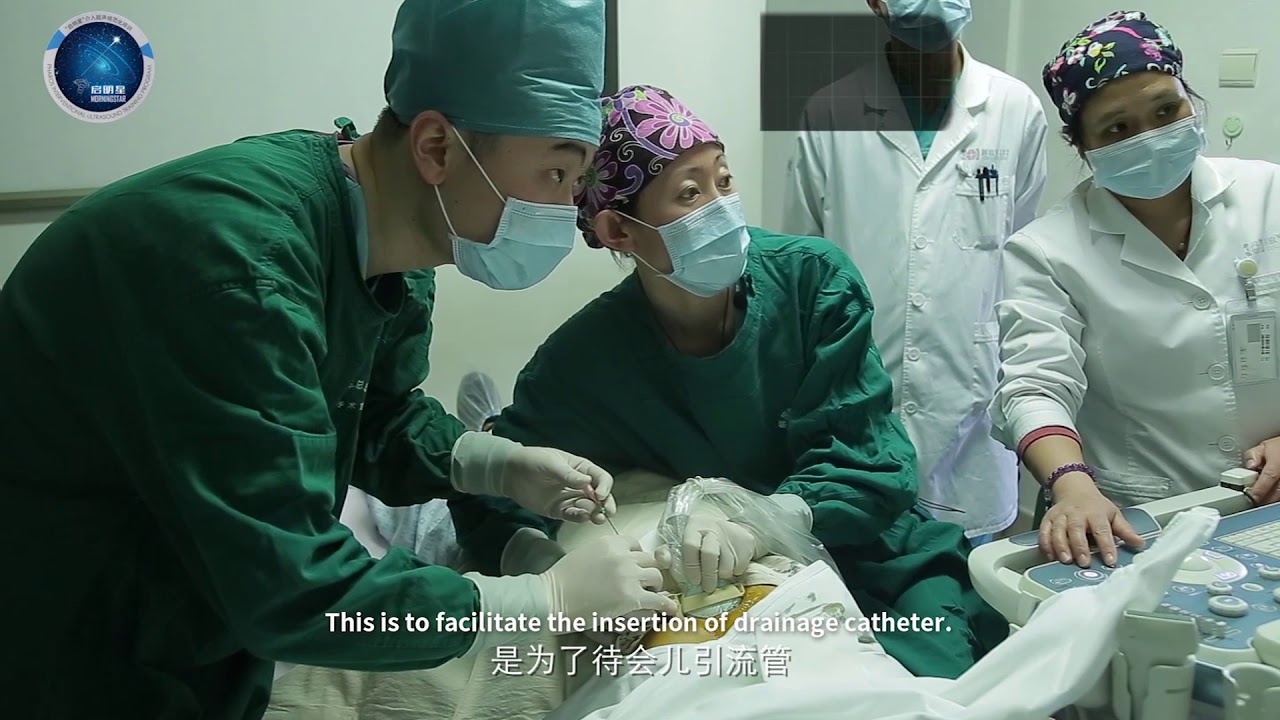 2 Step PTCD using the Ultrasound Needle Guides - YouTube