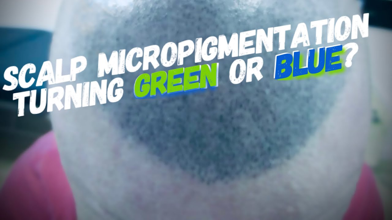 SMP Turning blue or green? Scalp Micropigmentation - YouTube