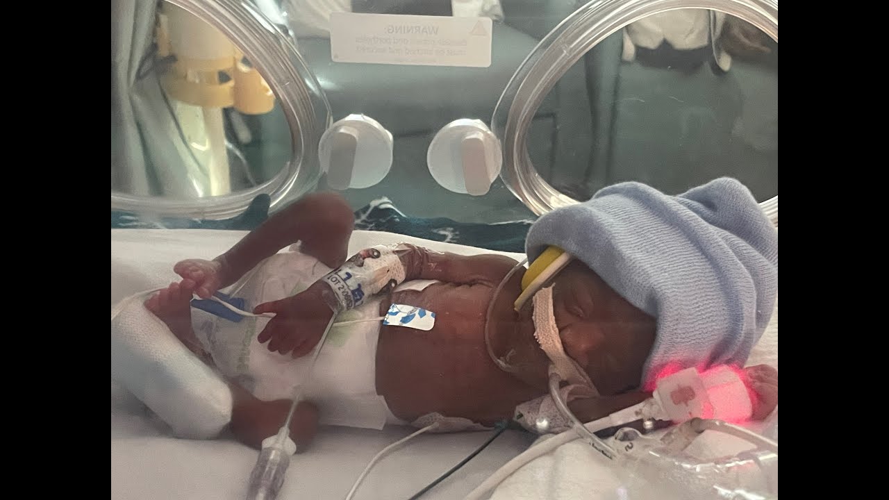 Exceptionally Chosen: NICU Journey of a “22-Weeker” - YouTube