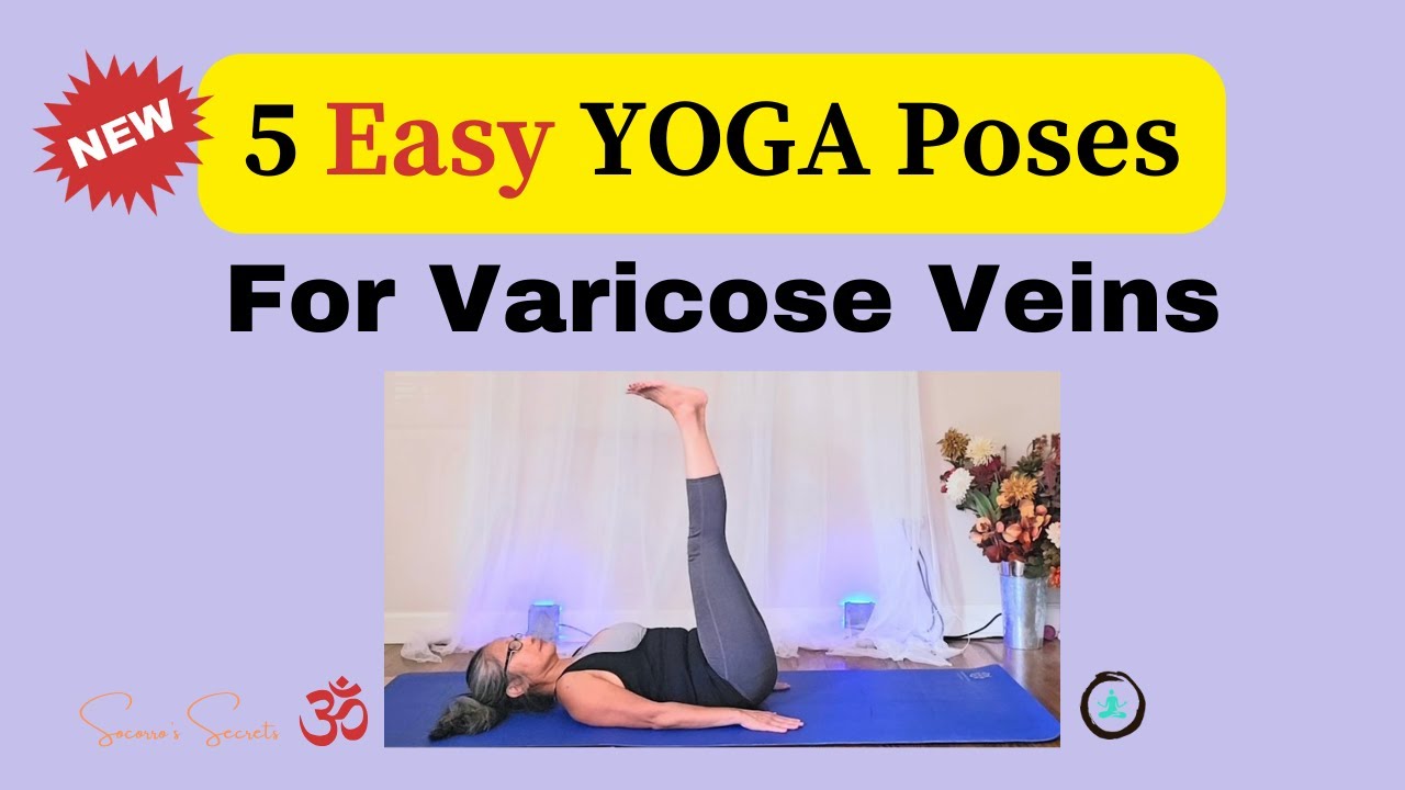 Yoga for Varicose Veins: 5 Gentle Poses to Try #yogaforhealth # ...