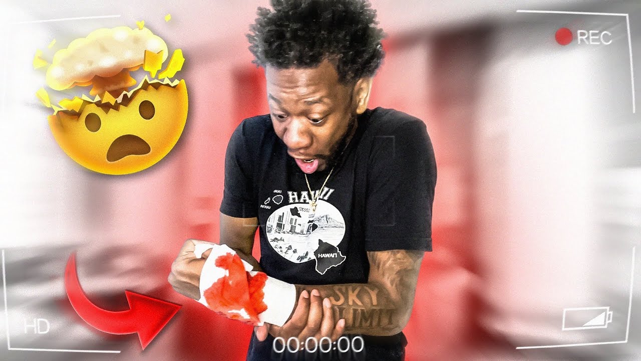 I CUT OFF MY HAND PRANK ON MY UNCLE !! (Prank) Must watch - YouTube