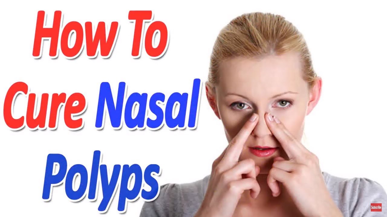 नाक की बीमारी का घरेलु उपचार How To Cure Nasal Polyps Youtube