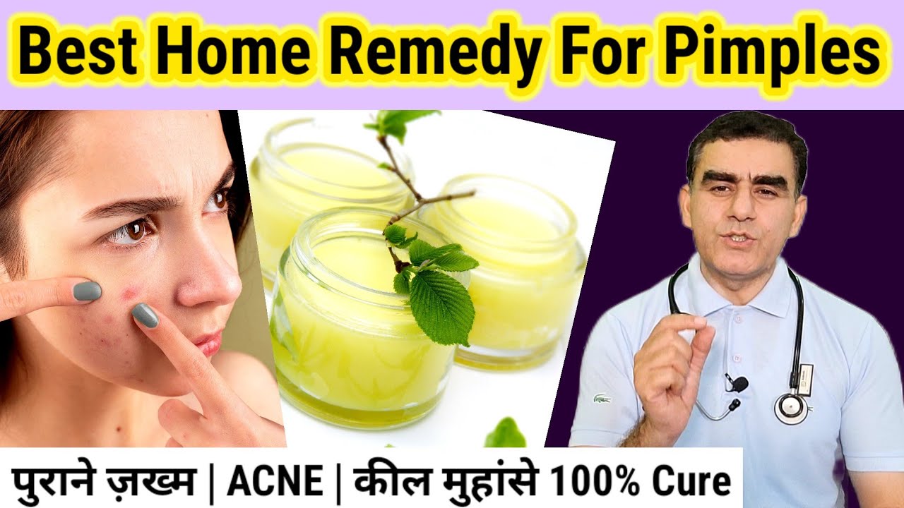 Home Remedy for Pimples on Face | Keel Muhase Theek Karne Ka Gharelu ...