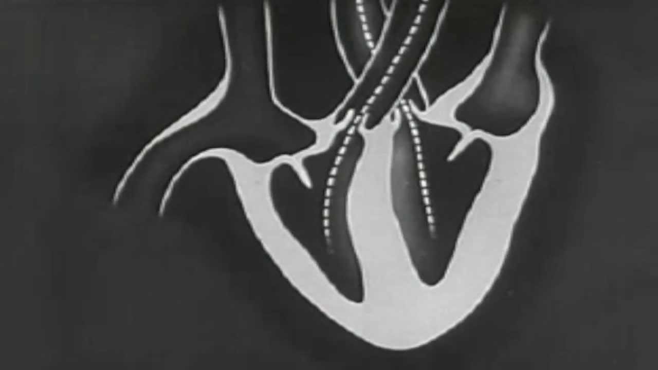 Autoheart - Lent (Bright Light Bright Light Remix) - YouTube