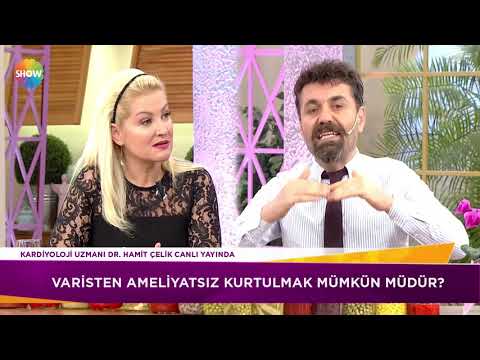 Varisten ameliyatsız kurtulmak mümkün mü?