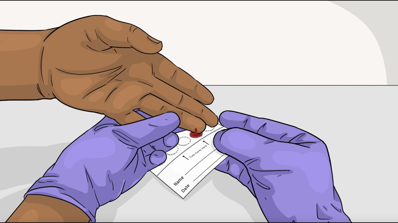 How to collect a dried blood spot sample - YouTube