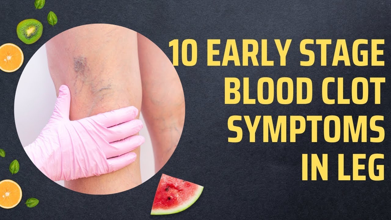 10 Early Stage Blood Clot Symptoms In Leg - YouTube