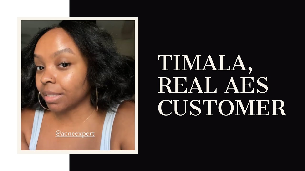 TIMALA, REAL AES CUSTOMER - YouTube