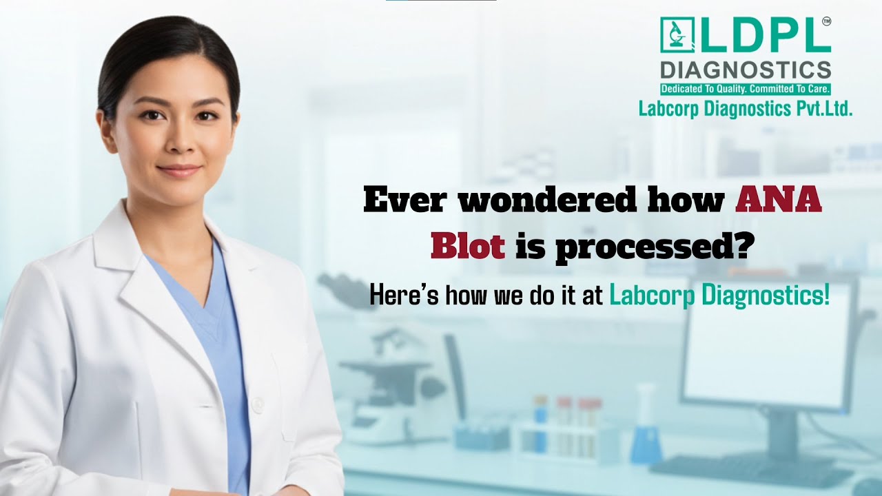 ANA Blot Test Process Explained | Step-by-Step at Labcorp Diagnostics ...
