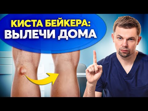 Главные ПРАВИЛА лечения боли под коленом. Избавься от кисты Бейкера НАВСЕГДА!