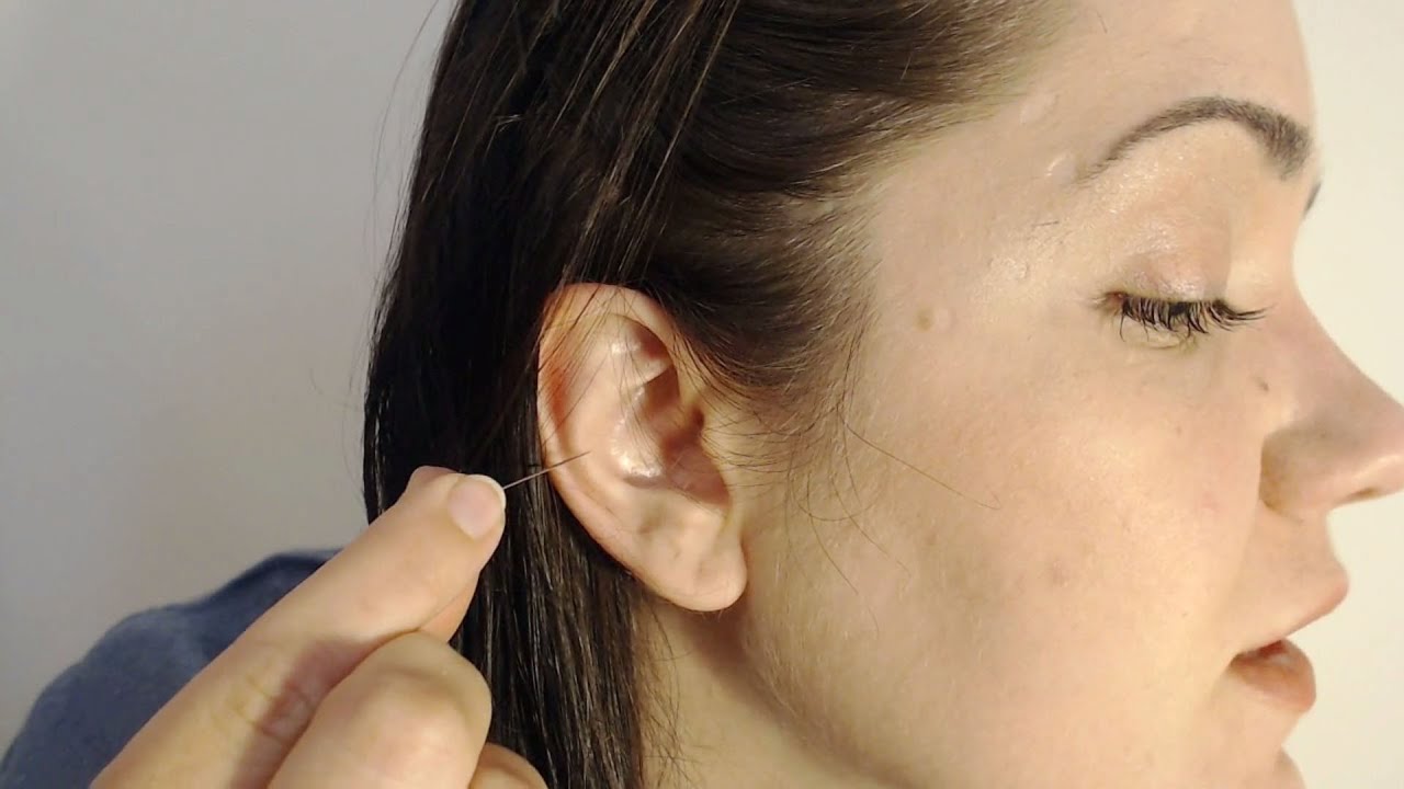 ASMR Short Acupuncture Session for Your Ears - YouTube