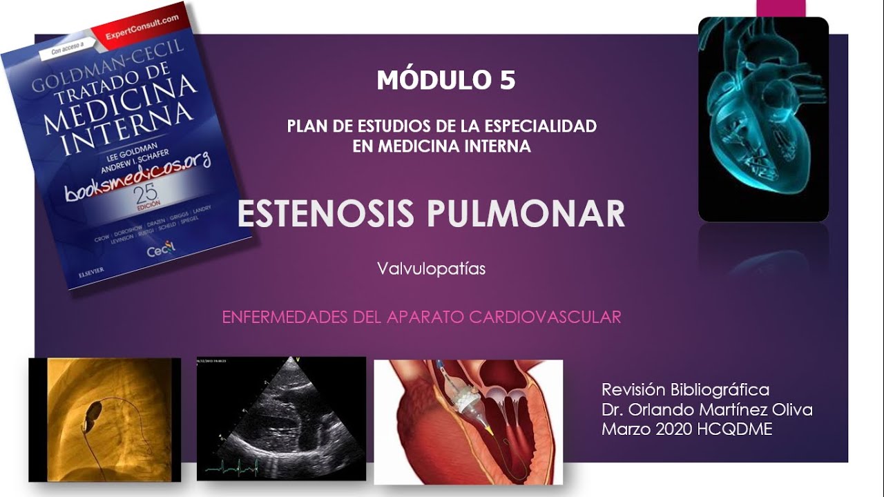 Estenosis Pulmonar (EP) - YouTube