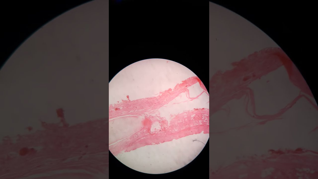 Embriología Esófago 4X Microscopía - YouTube
