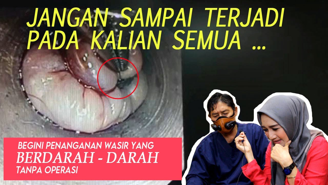 Wasir Bisa Sembuh Tanpa Operasi? Begini Caranya! - YouTube