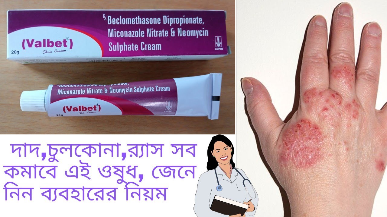 Valbet Cream use for rash,eczema, athlete's foot,psoriasis - YouTube