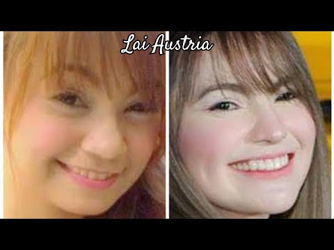 Toni Fowler • Jelai Andres • Lai Austria BEFORE AND AFTER GLOW UP EDITION