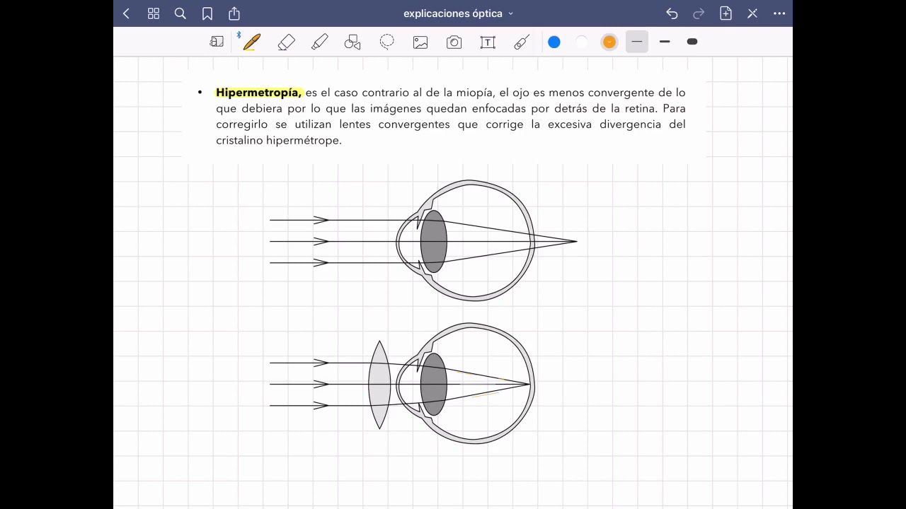 Teoría defectos del ojo - YouTube