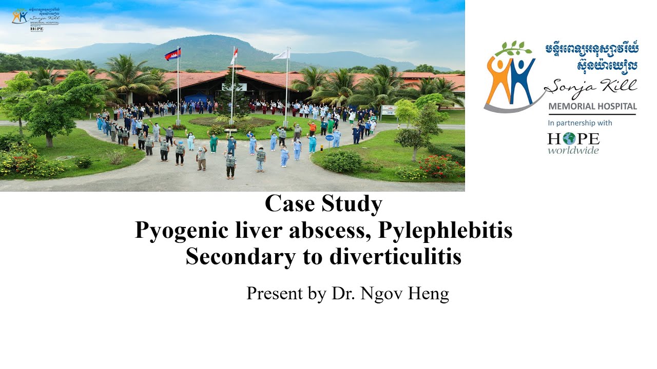 Pyogenic liver abscess, Pyle phlebitis Secondary to diverticulitis Dr ...