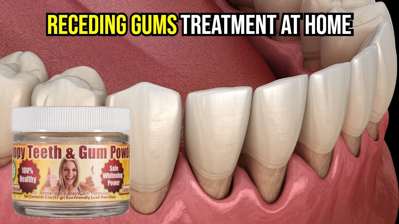 Gum Recession Treatment At Home | Revive Happy Teeth & Gum Powder ...